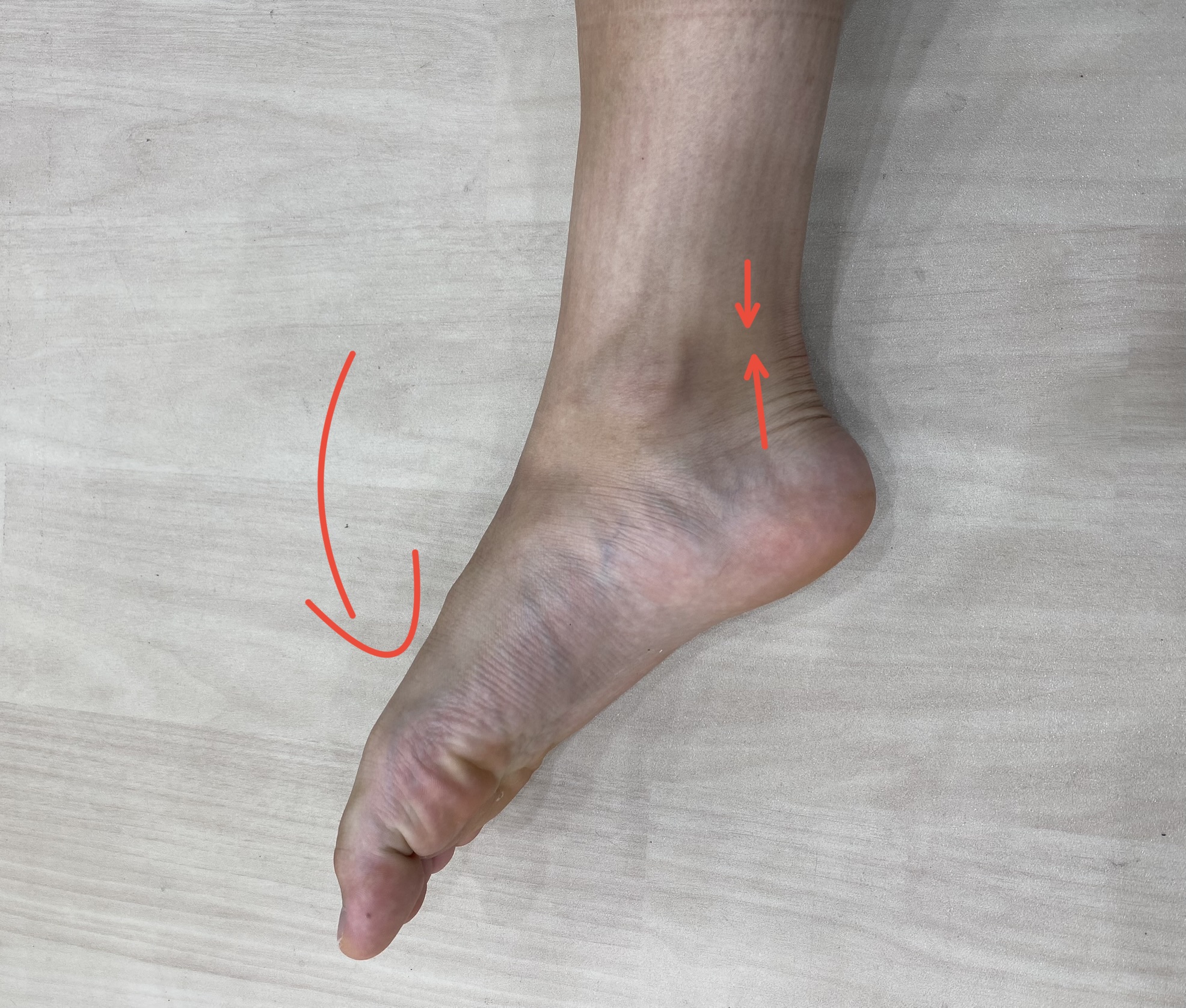 ケーラー脂肪体③