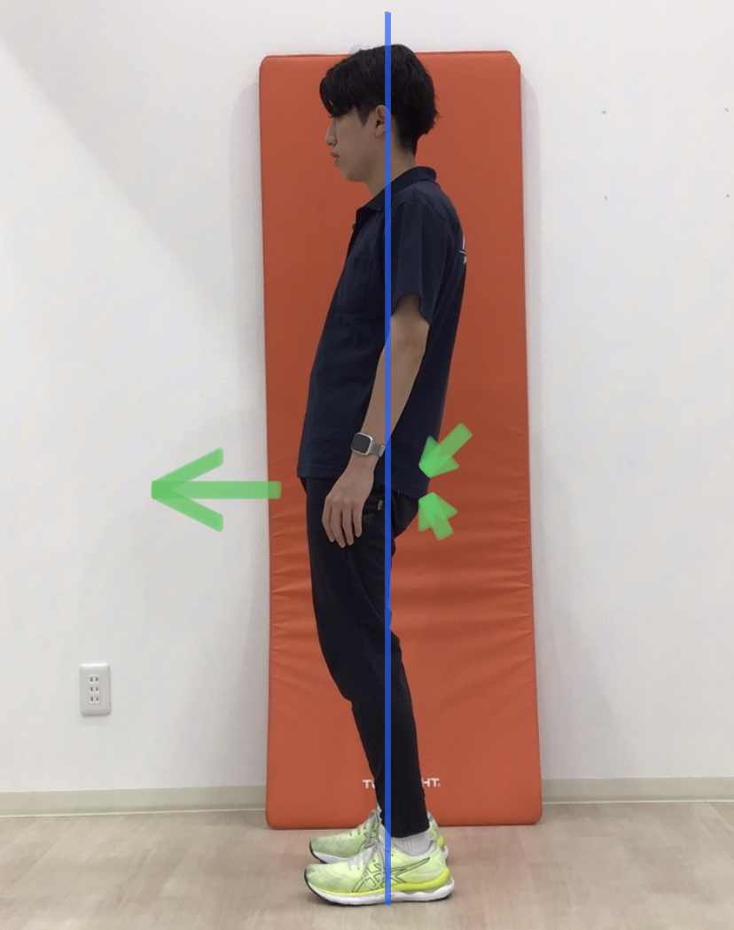 骨盤後傾前方突出